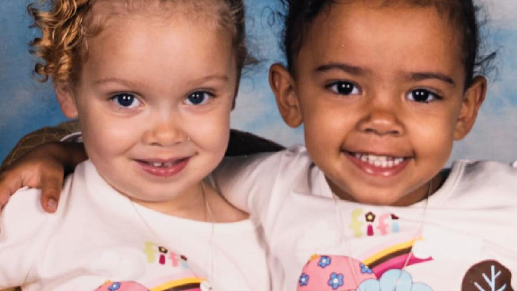 Son mellizas y muy distintas: las hermanas blanca y negra que nacieron ...