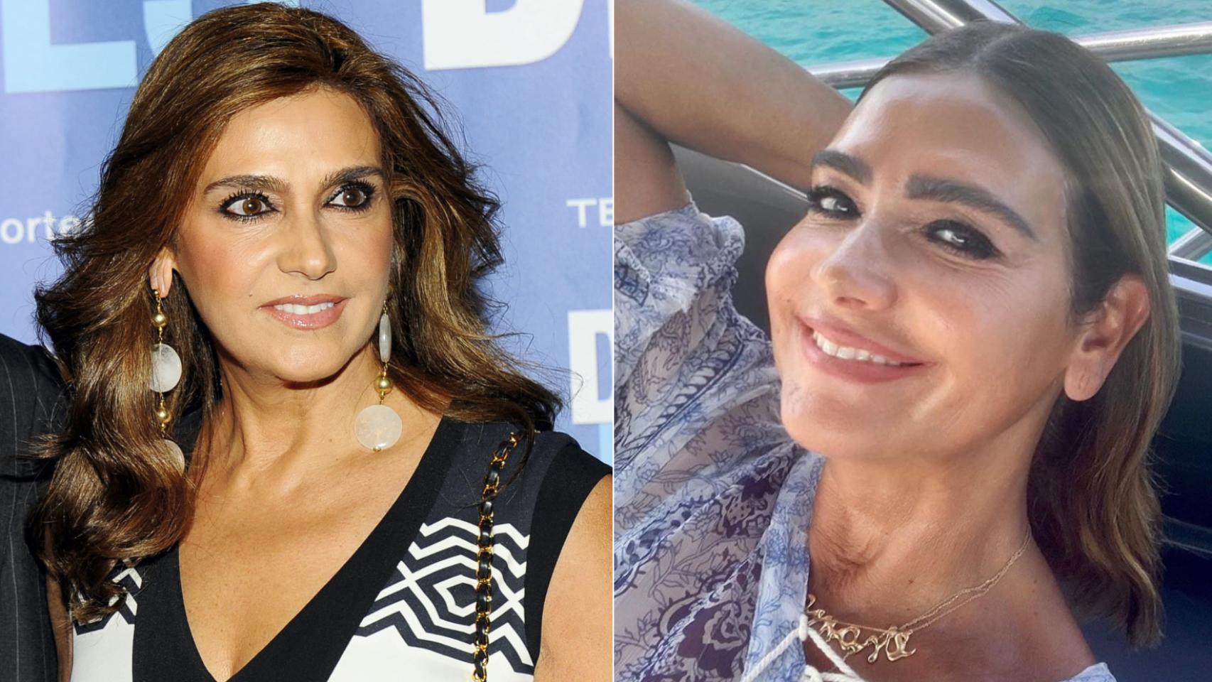 Marina Danko, la reina del bisturí: luce nueva cara por 2.100 euros