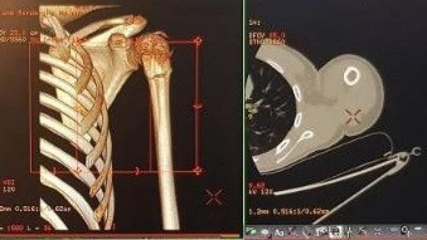 Allan Cormack: 100 años del Nobel inventor del TAC