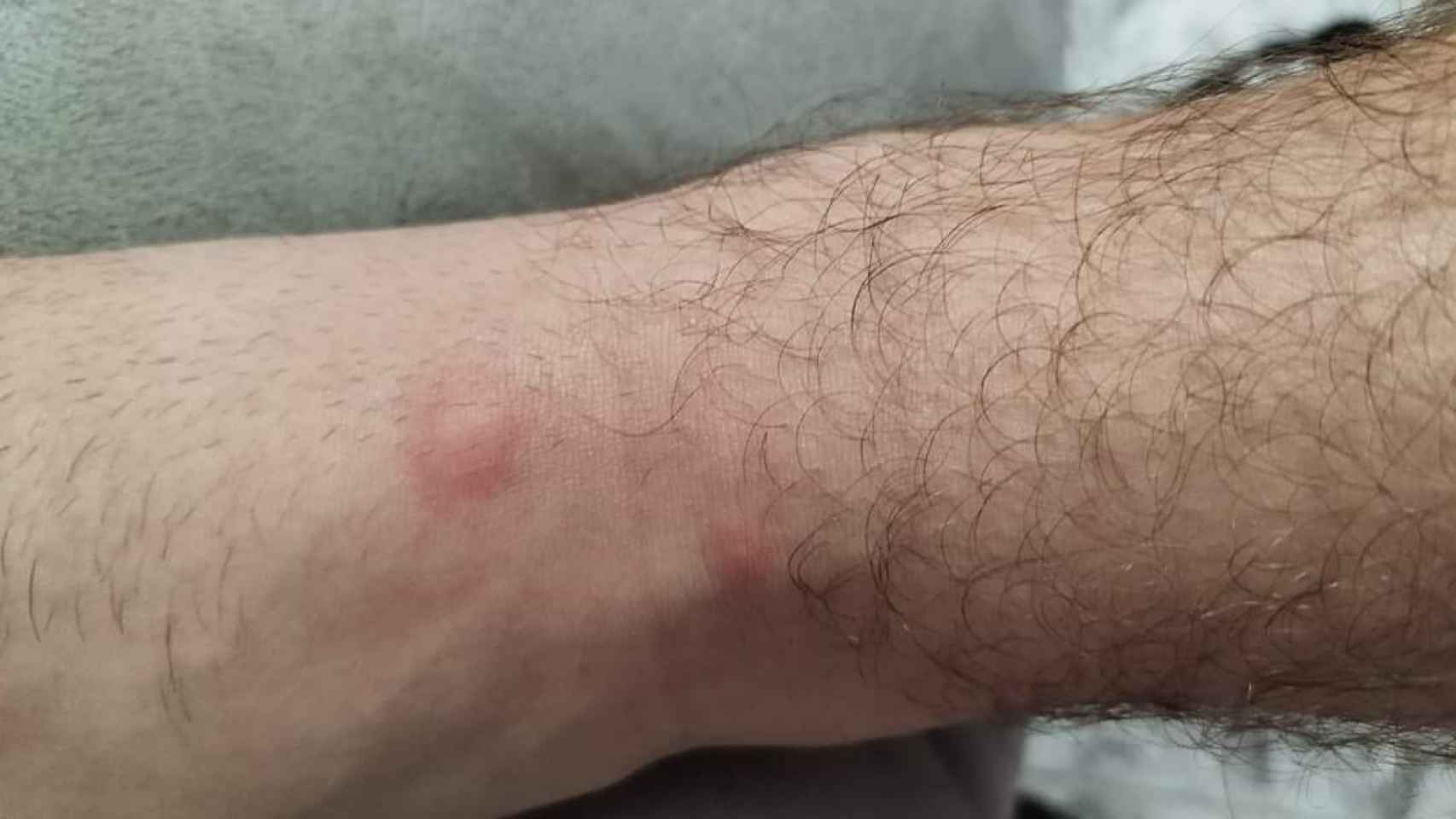 Alertan de una plaga de insectos en una piscina de Toledo: "Pueden ser ...