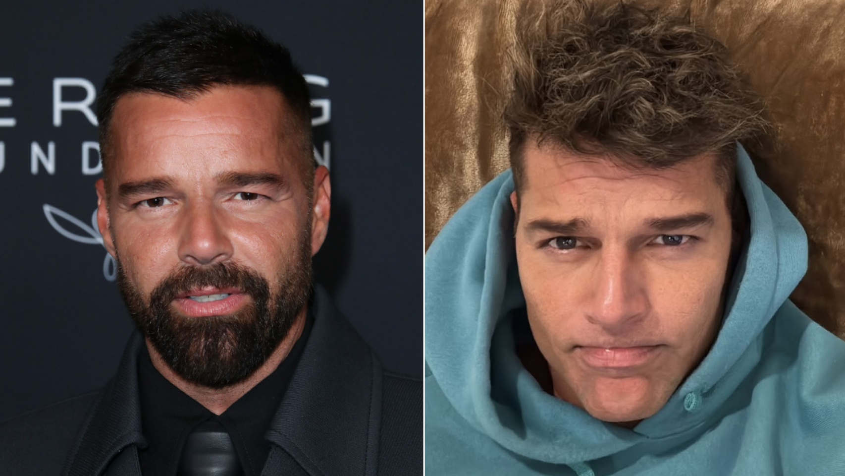 La gran transformación de Ricky Martin a sus 53 años: los tratamientos en su cara que lo han ...