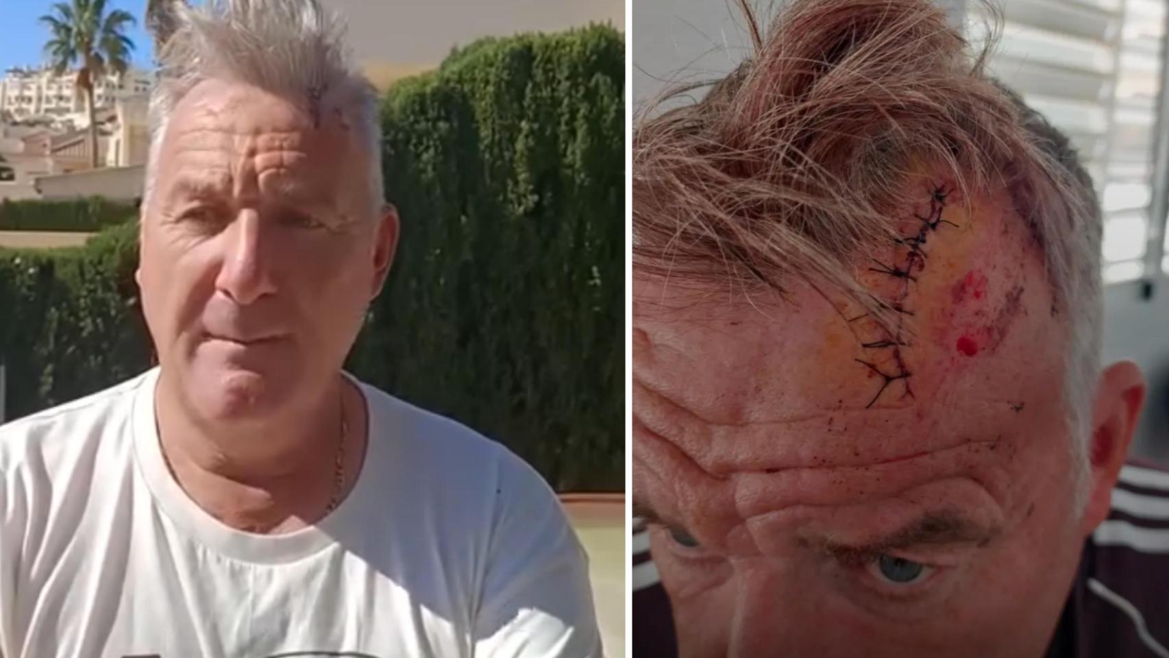 David Homer, atacado con un cuchillo en Orihuela Costa durante su ...